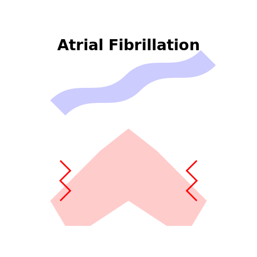 Atrial Fibrillation - An Electrical Storm in the Heart - Funny Comment ...